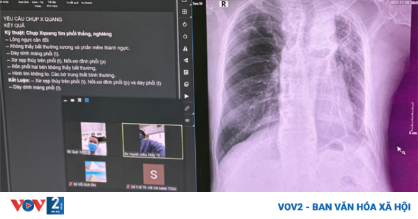 Trạm y tế đầu tiên trên cả nước ứng dụng trí tuệ nhân tạo | VOV2.VN