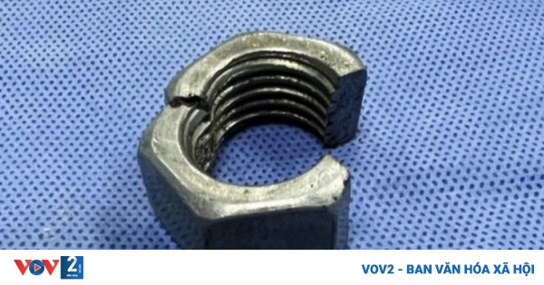 Gắn đai ốc vào vùng kín, người đàn ông phải nhập viện cấp cứu | VOV2.VN